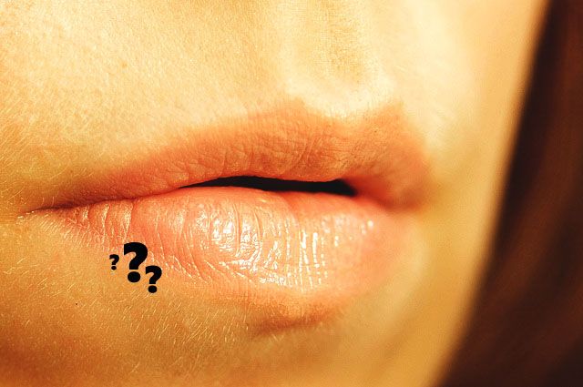 What other conditions can be mistaken for a cold sore?